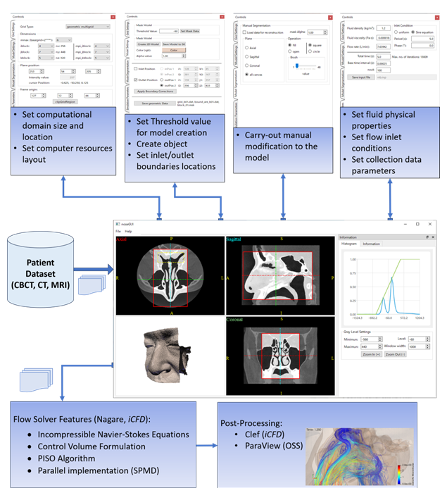 鼻腔気流の計算システム | iCFD