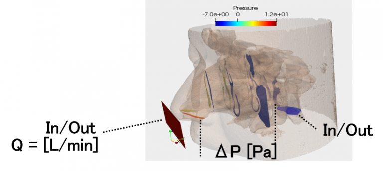 3D 鼻モデル内の気流をシミュレーションする | iCFD